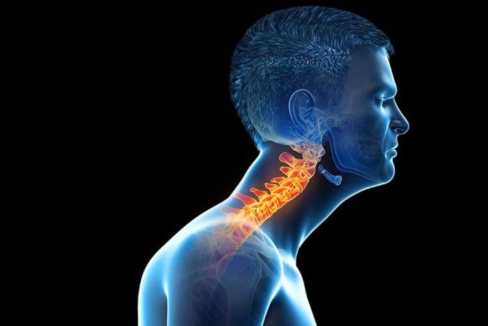 FORWARD HEAD SYNDROME – Sunset Chiropractic & Wellness – Miami ...